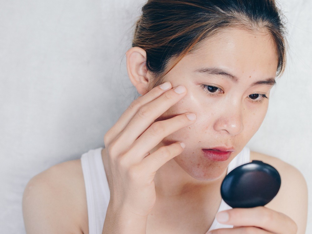 Tanpa Disadari, Ini 5 Faktor yang Menjadi Penyebab Munculnya Flek Hitam ...