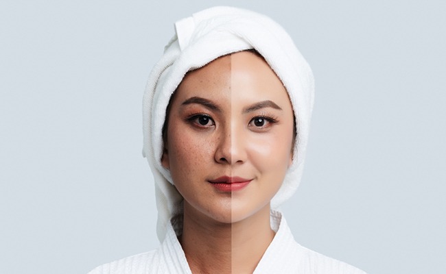 Mengenal Jenis-Jenis Vitamin C yang Terkandung dalam Skin Care - Beauty ...