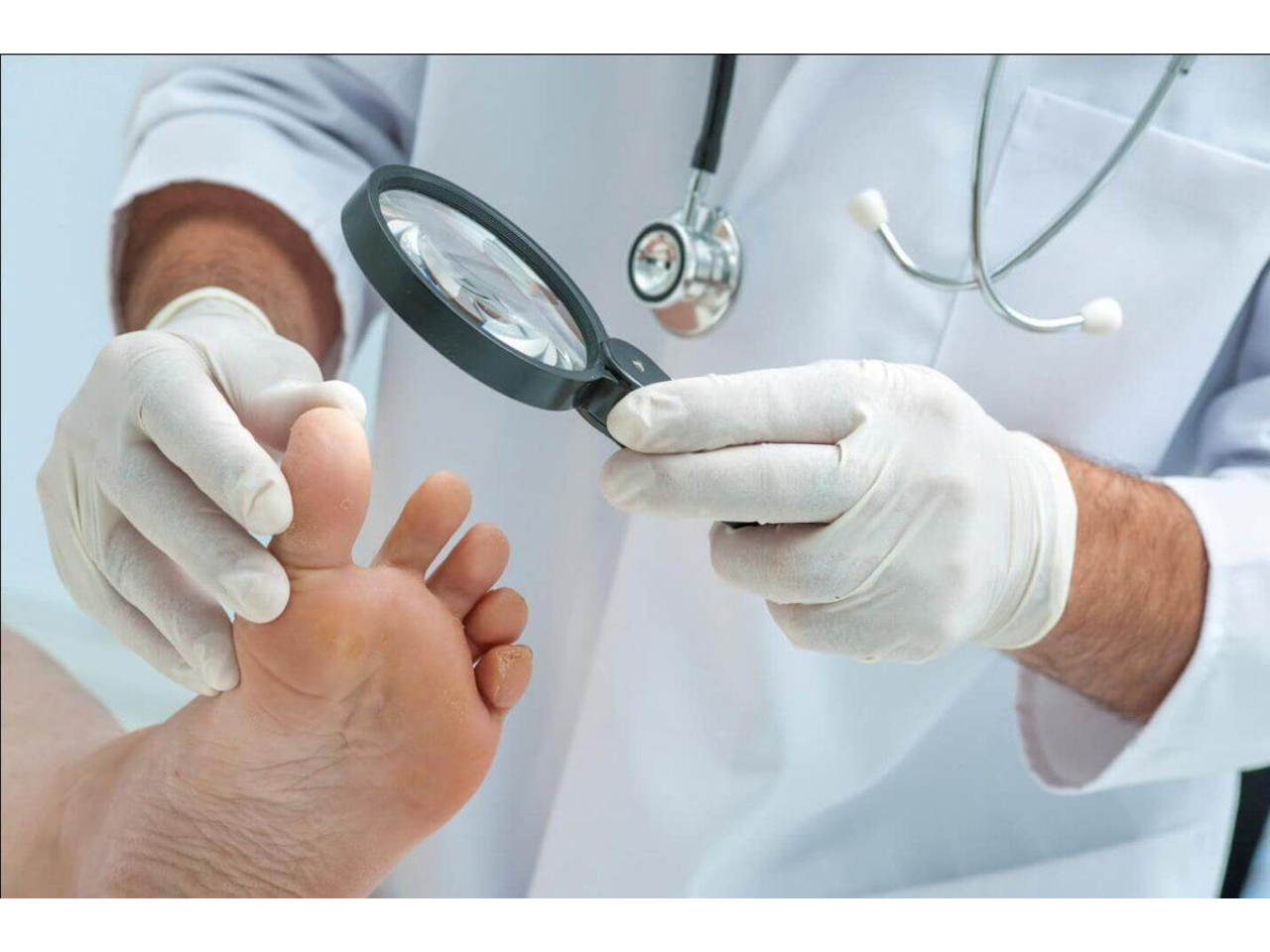 Kenali Jenis dan Penyebab Infeksi Jamur pada Kulit Berikut Ini - Beauty ...